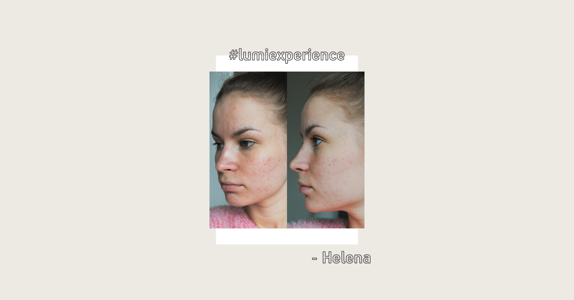 HELENA’S SKIN STORY - Luminordic